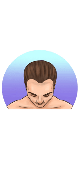 Recede.io